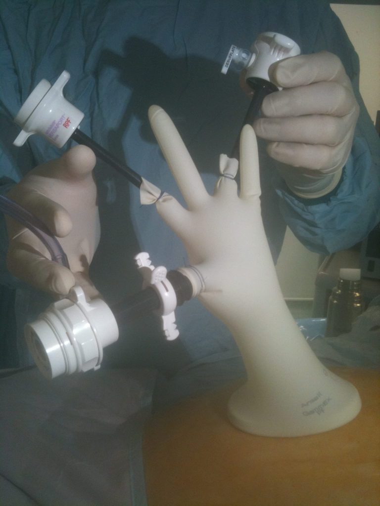 Glove Port and Single Port - Oxford Colon Cancer Trust